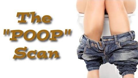 Transabdominal Ultrasound: Key Tool for Pediatric Fecal Impaction ...